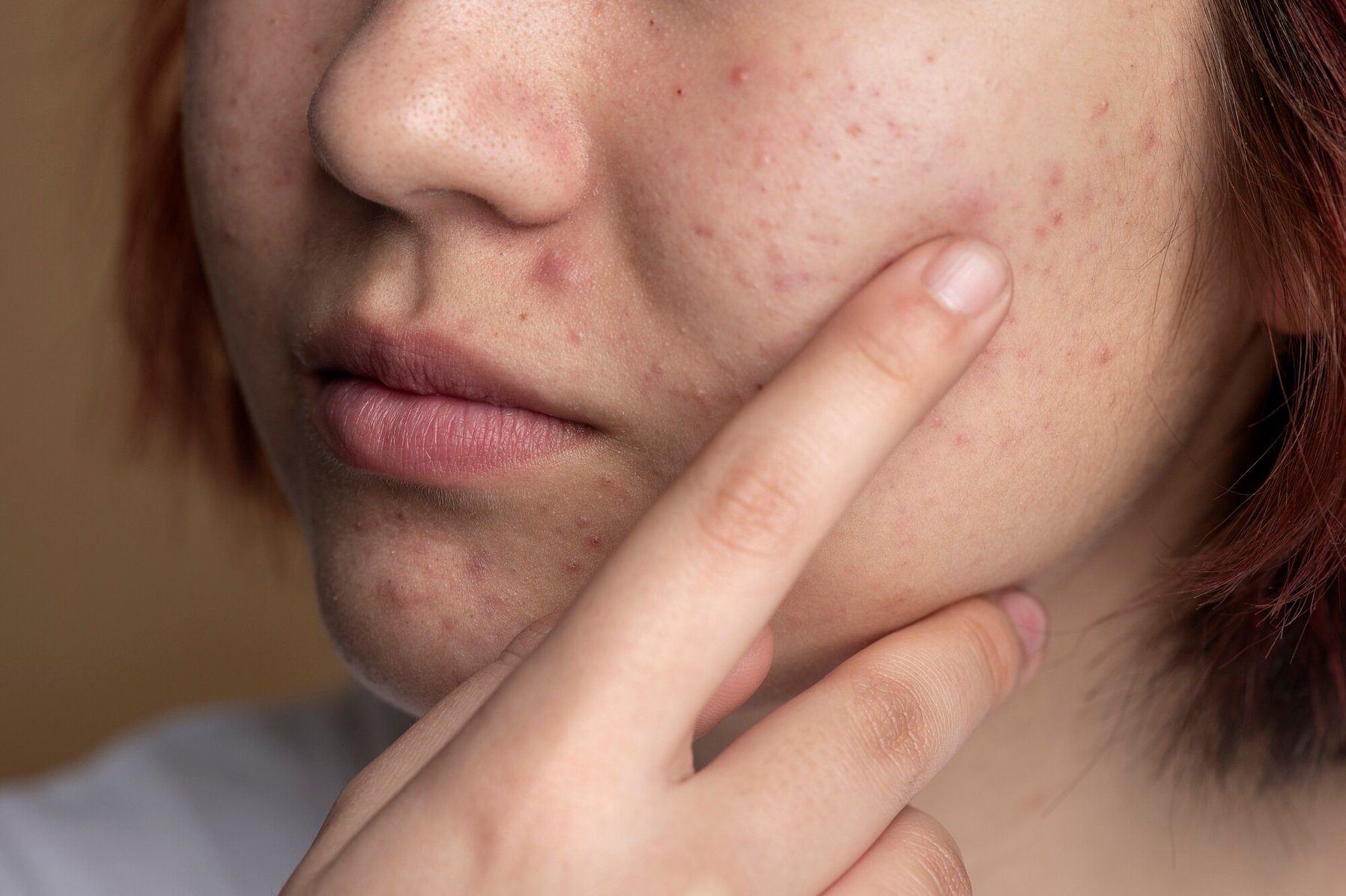 Sun Damaged Skin (Photoageing): A Complete Guide