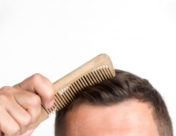 Hairline Varieties: A Comprehensive Guide