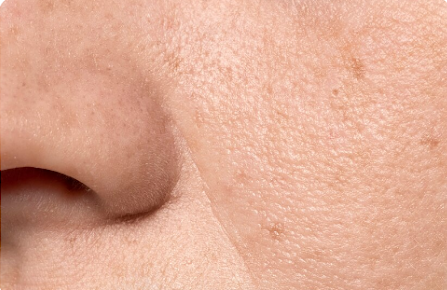 Build Your Skin Care Routine for Oily Teenage Skin